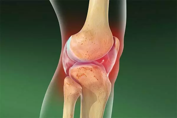 What symptoms indicate that you have arthrosis