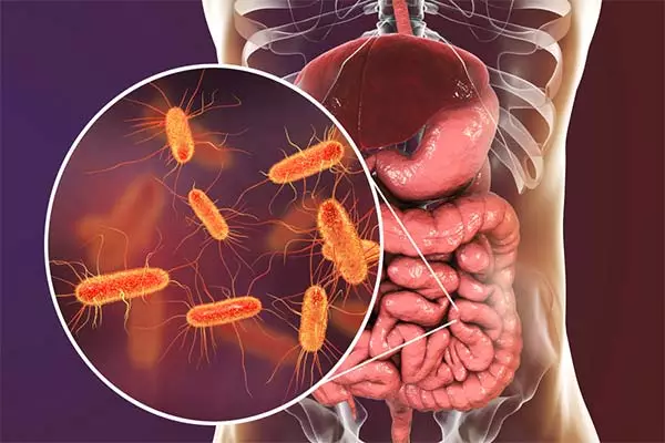 dysbacteriosis کے لئے خطرناک اور نقصان دہ کھانے کی اشیاء