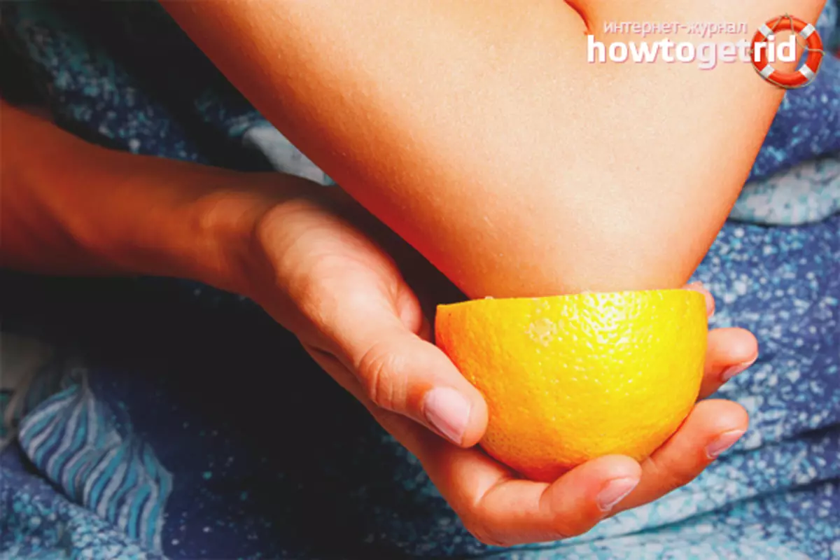 Whitening Elbow Lemon.