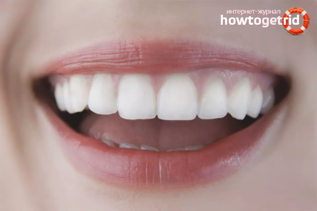 How to align your teeth