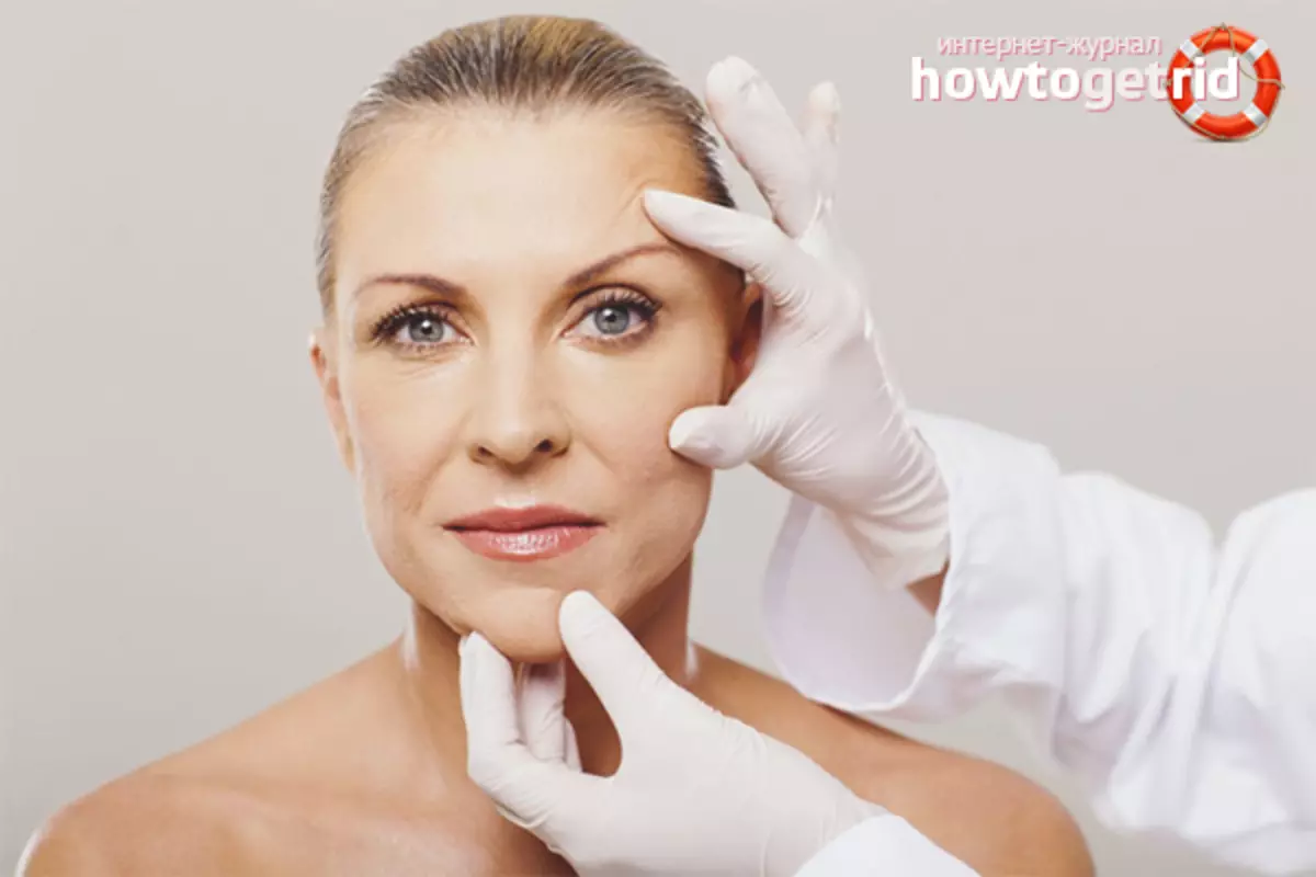 Hoe ontdoen van Nasolabial Folds